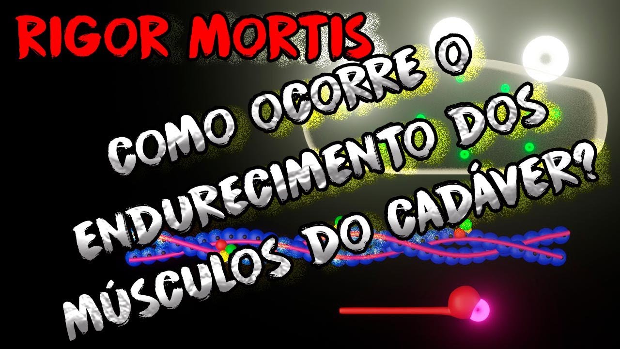 Rigidez Cadavérica - Rigor mortis - YouTube