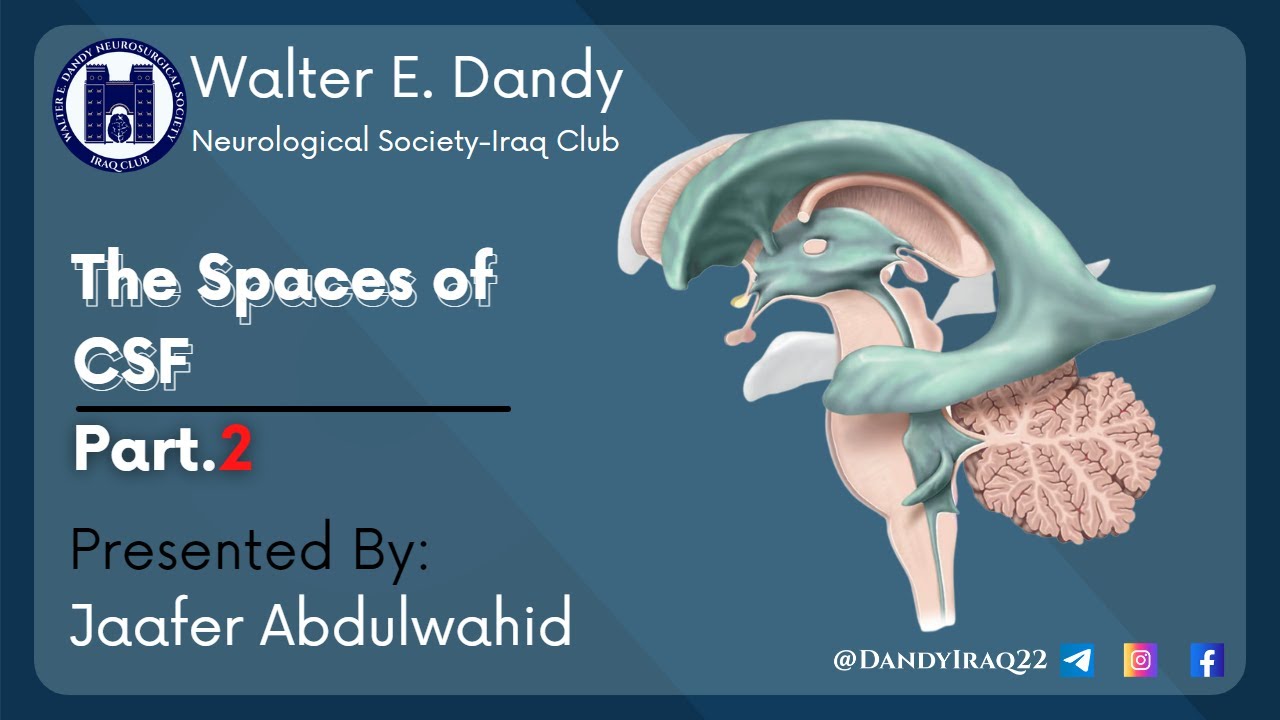 The Spaces of CSF | Part.2 - YouTube