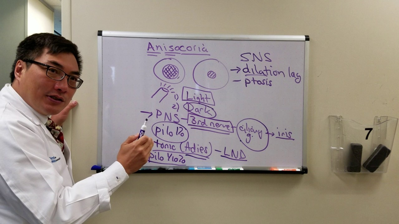 Anisocoria - YouTube