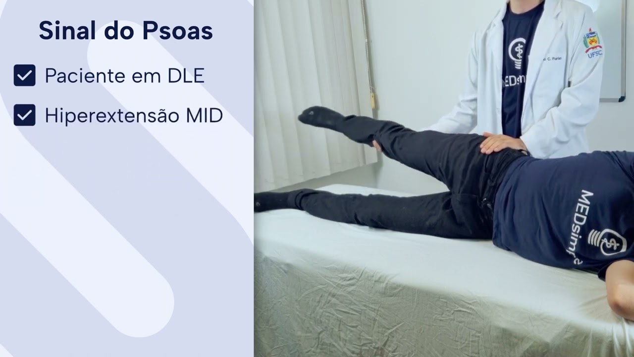Sinal De Psoas