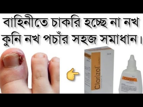 Clarizol | মারাত্মক নখকুনি নখ পচাঁ থেকে ১০০% চিরমুক্তি | যারা বাহিনীতে ...