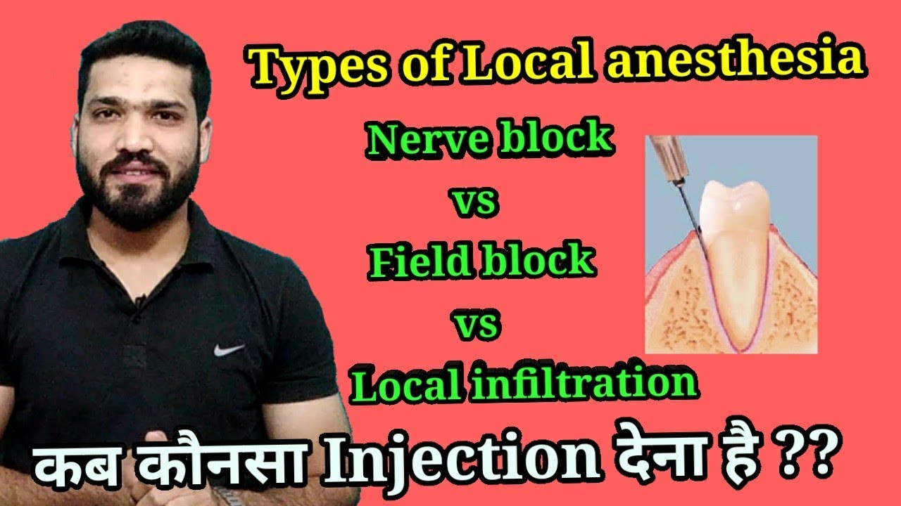 Types Of Local Anesthesia Injection YouTube types-of-local-anesthesia-injection-youtube