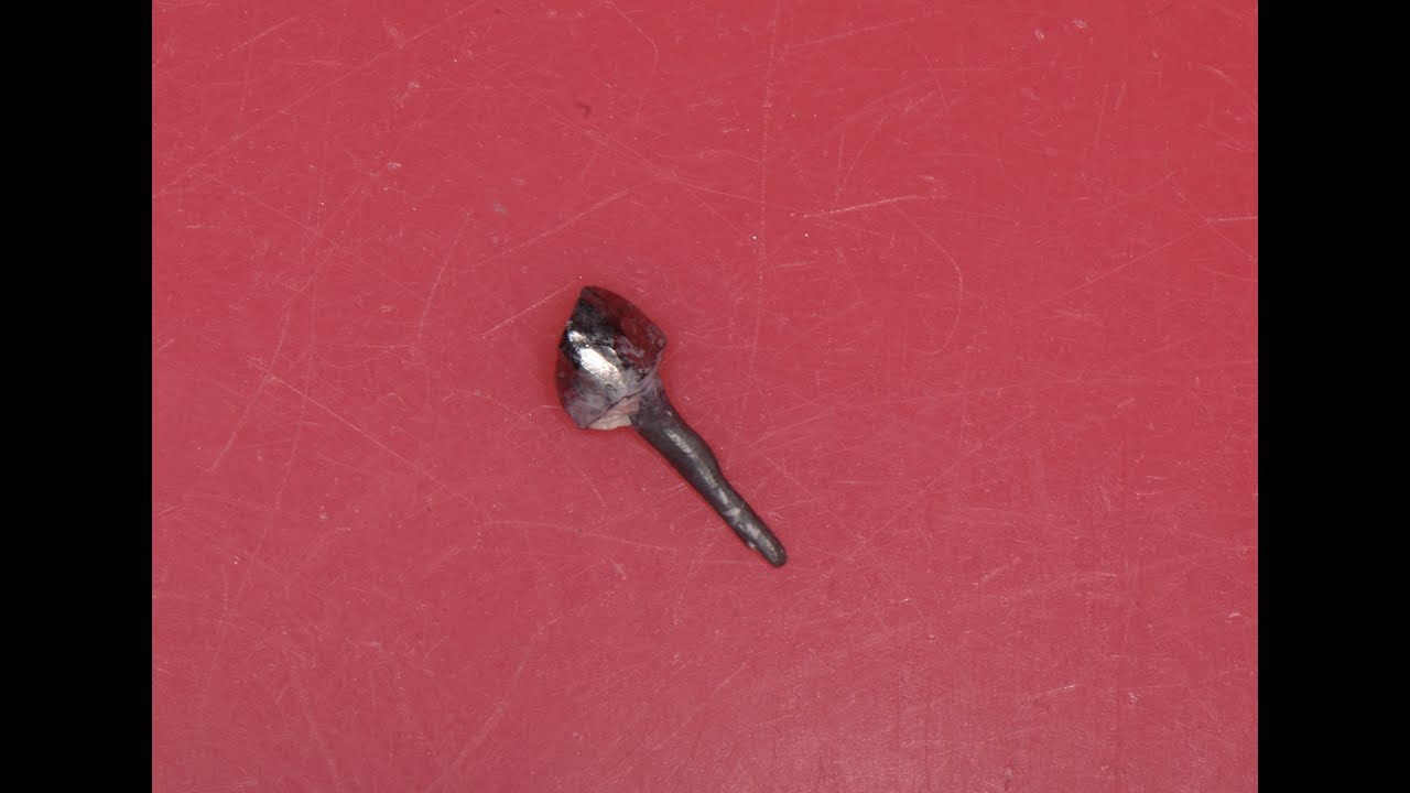 Dental Metal post removal - YouTube