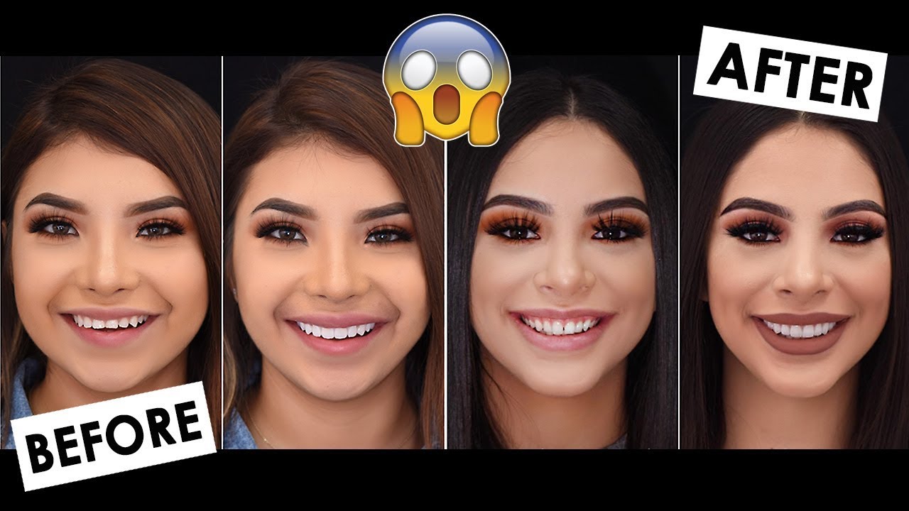Our Crazy Teeth Transformation Shocking Youtube