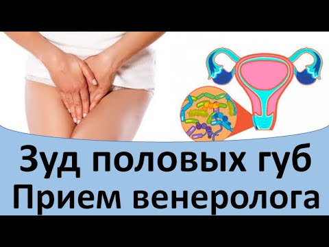 Зуд половых губ. Прием венеролога - YouTube