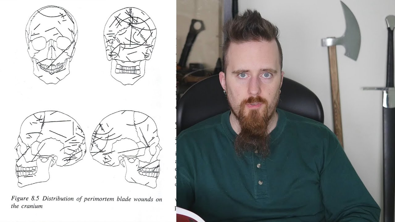 Go for the head - injuries from the medieval battle of Towton (1461 ...