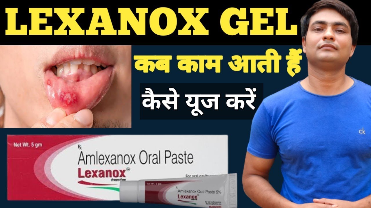 lexanox gel uses in hindi | lexanox gel | lexanox paste | lexanox paste ...
