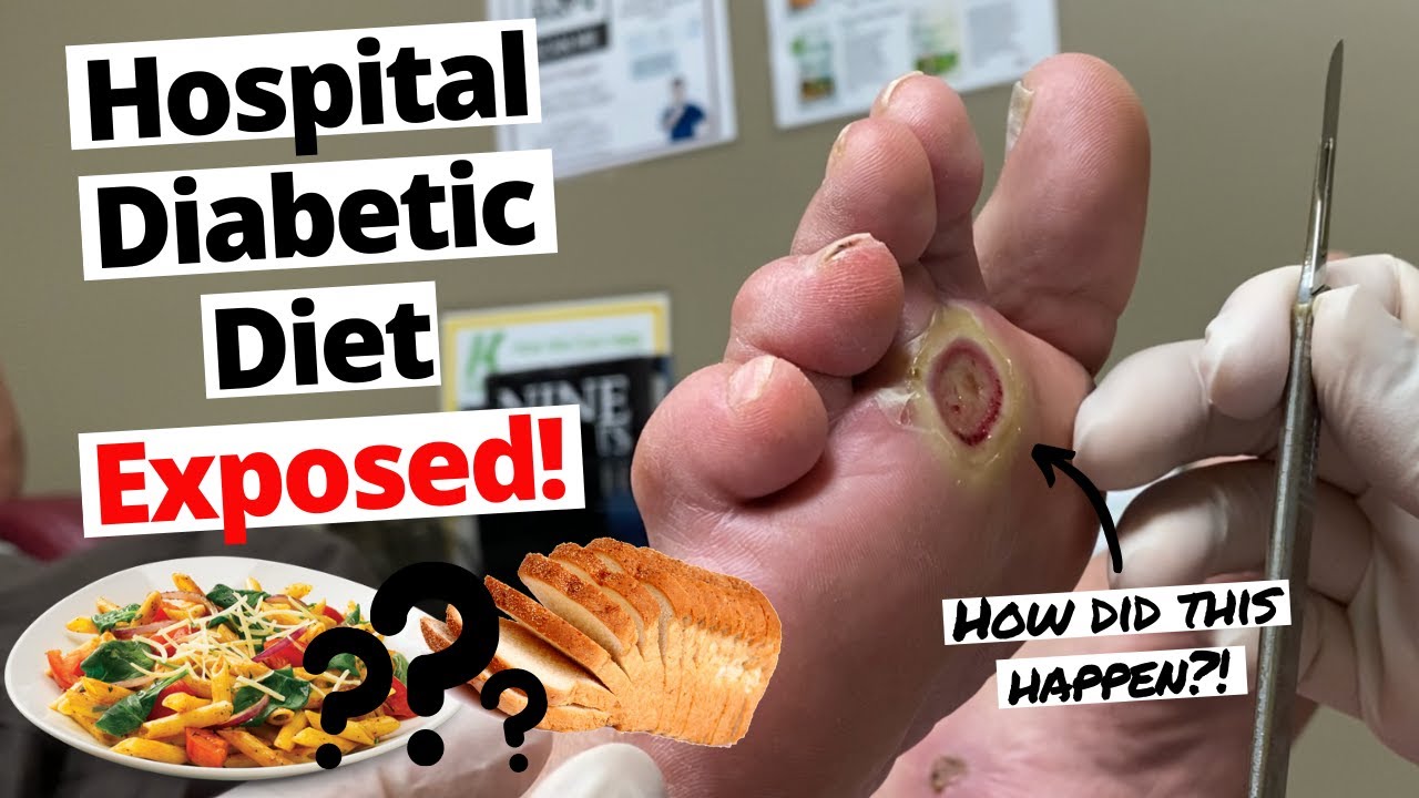 Hospital Diabetic Diet EXPOSED YouTube hospital-diabetic-diet-exposed-youtube