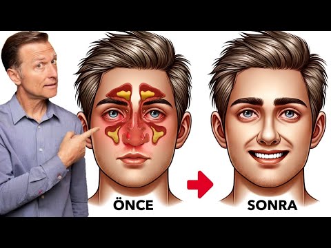 Sinüslerinizi Açacak En İyi Çözümler | Dr. Berg Türkçe