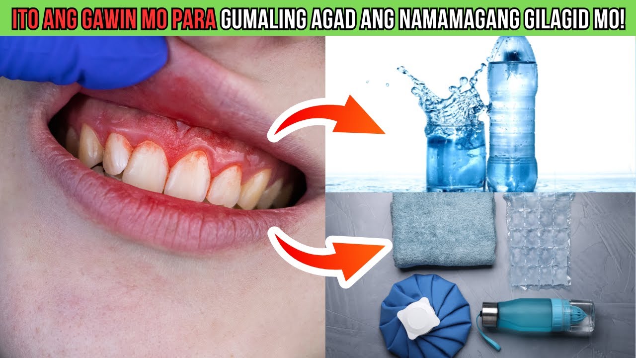 TOP 5 GAMOT at LUNAS sa NAMAMAGANG GILAGID! - YouTube
