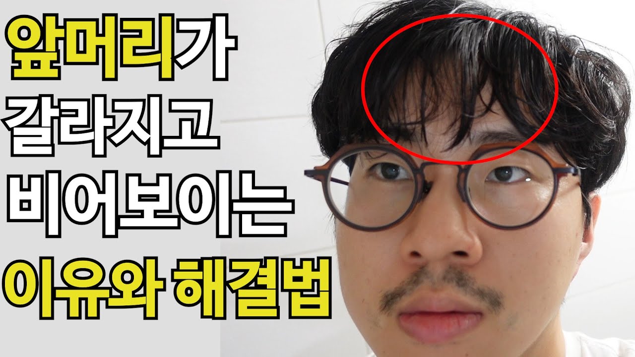 남자 앞머리 갈라지는 이유와 해결법 Youtube