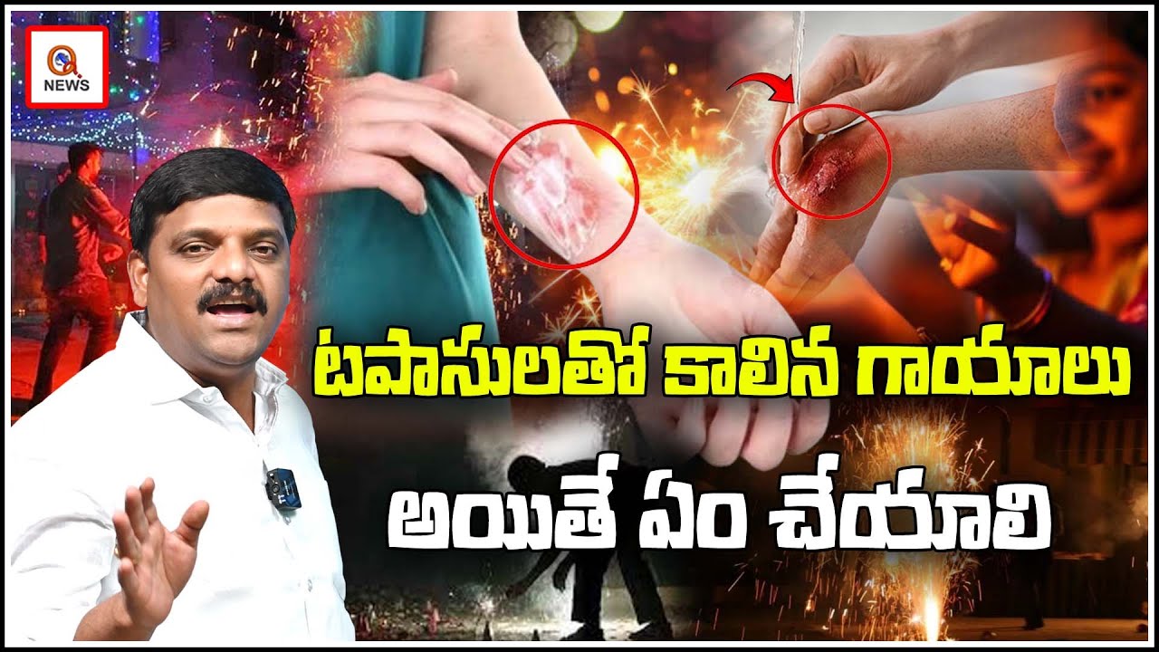 What to Do in Case of Firecracker injuries Burns ?.QnewsHD - YouTube