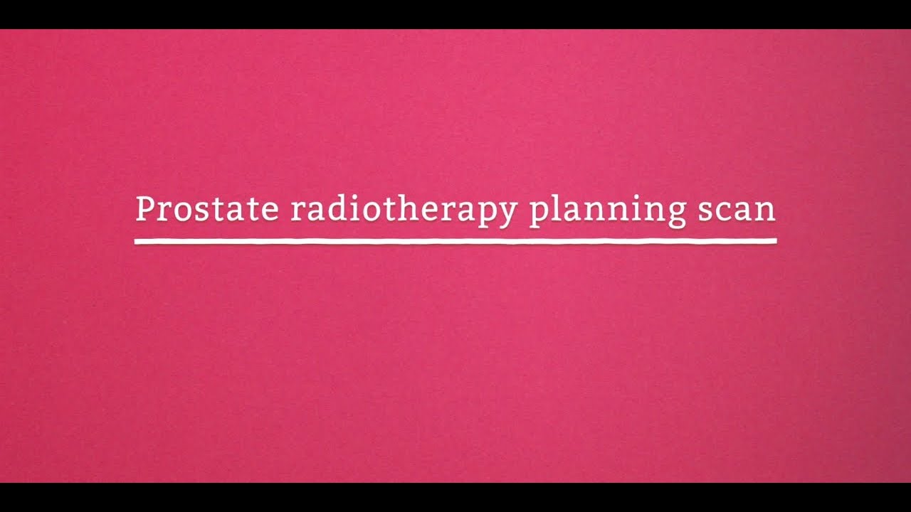 Prostate radiotherapy planning scan - YouTube