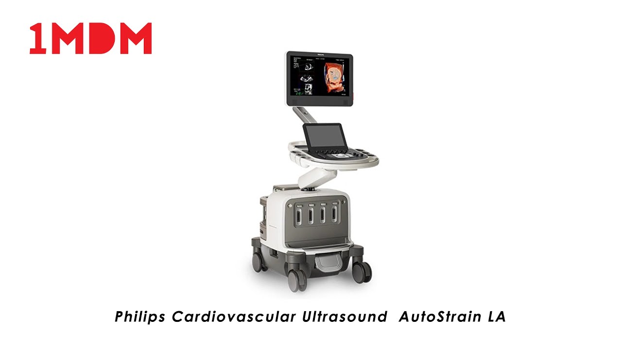 Philips Cardiovascular Ultrasound AutoStrain LA - YouTube