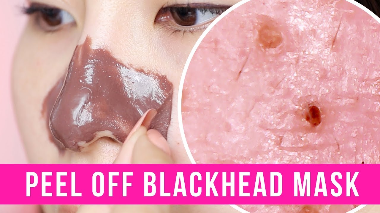 Peel Off Blackhead Mask Under a Microscope - YouTube