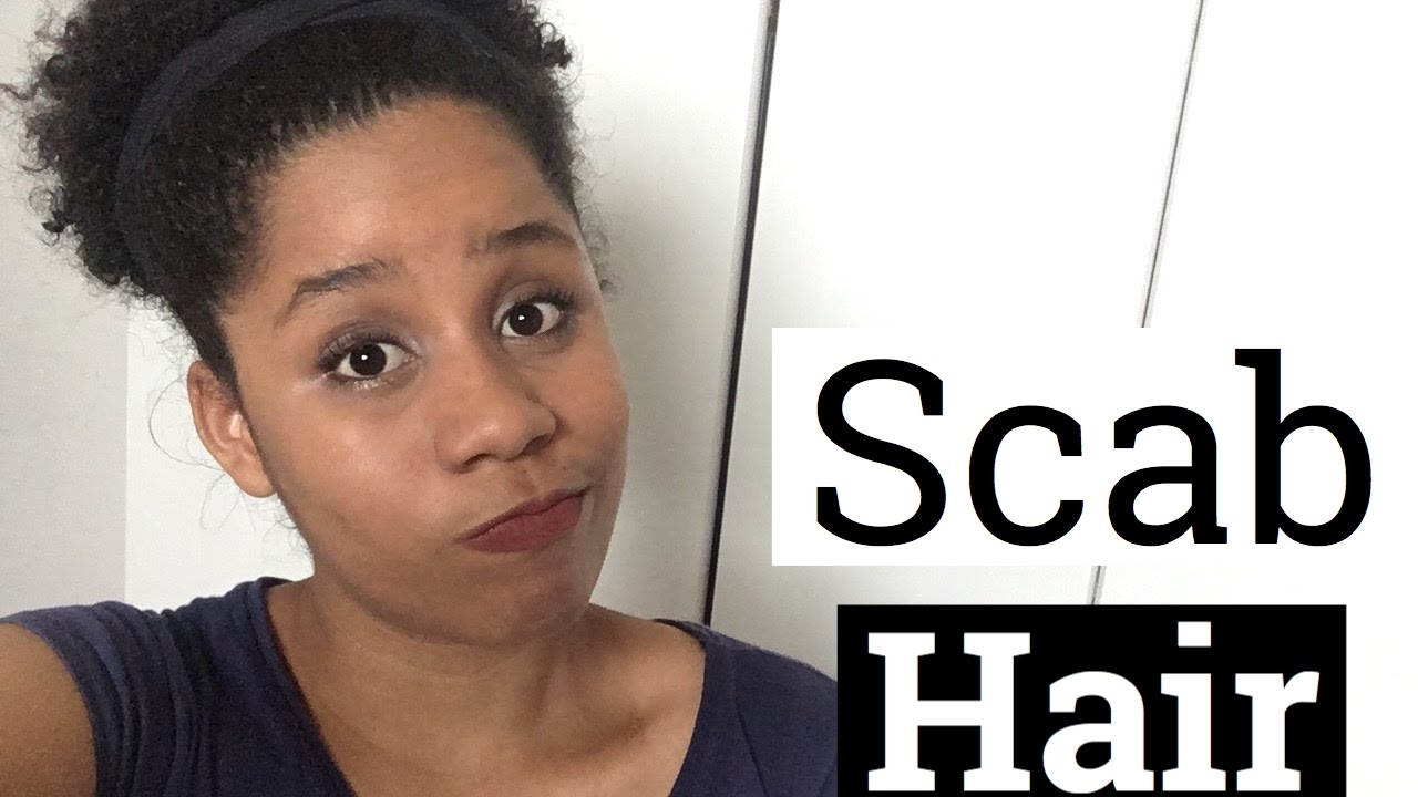 SCAB HAIR | O QUE É? COMO TRATAR? - DIÁRIO DE TRANSIÇÃO #09 - YouTube