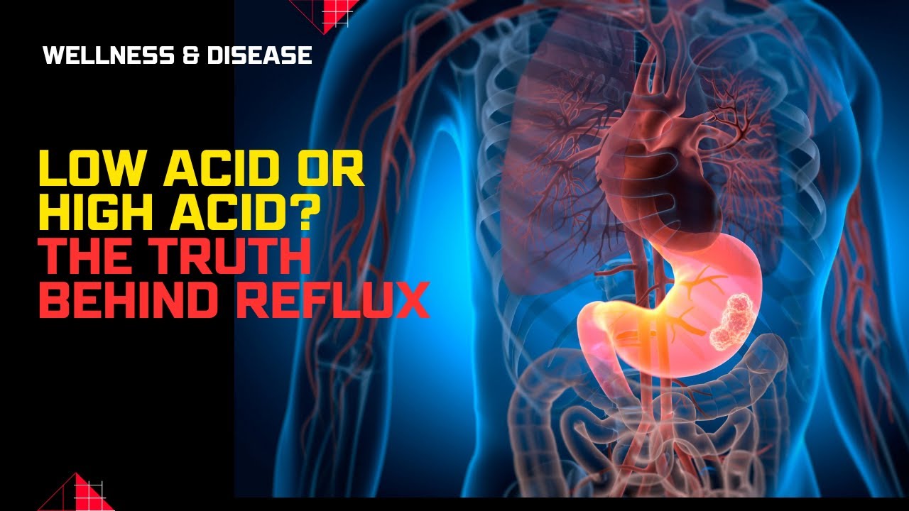 The Shocking Truth About Acid Reflux: It’s NOT Too Much Acid - YouTube