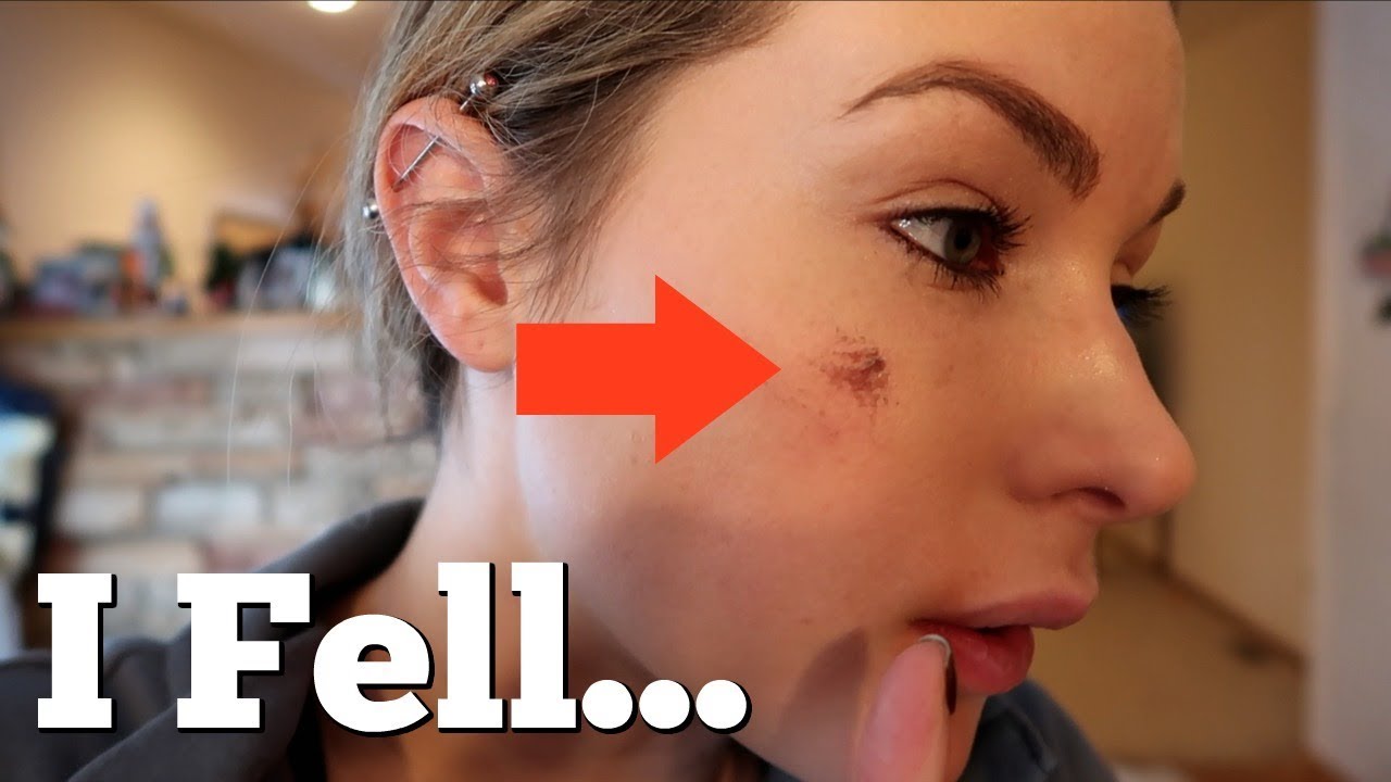 I fell On My Face... - Pranksters in Love Vlog - YouTube