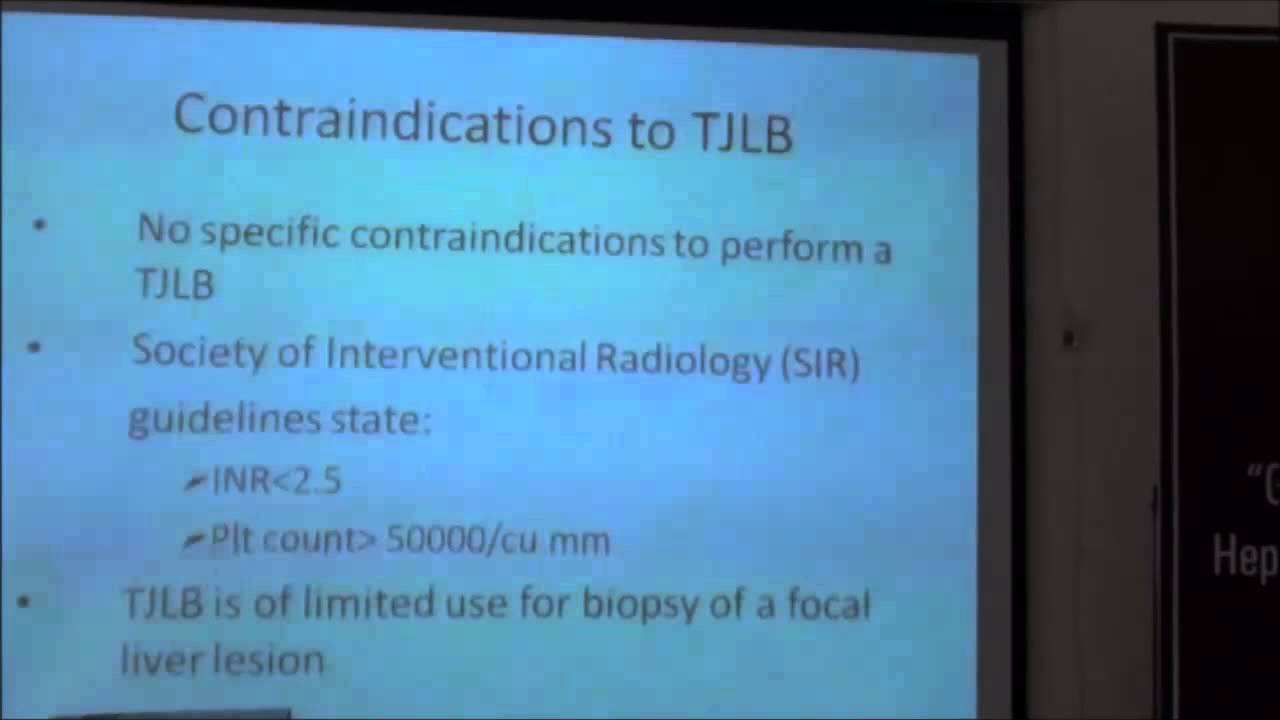 transjugular liver biopsy - YouTube