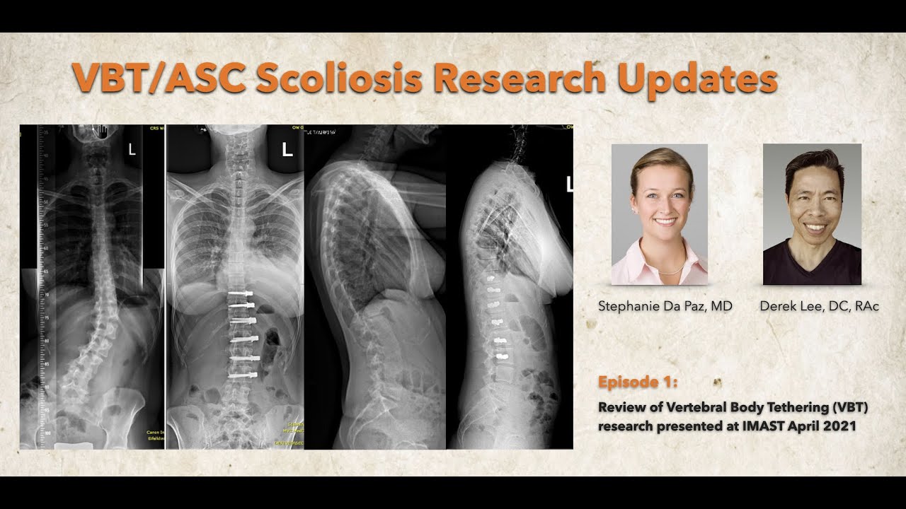 VBT/ASC Scoliosis Research Updates - Episode 1 - YouTube