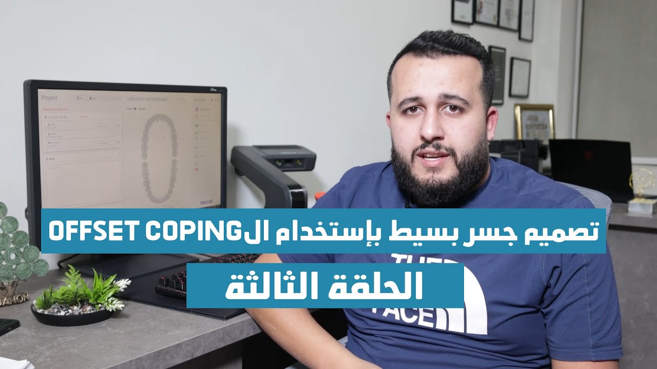 Episode 3 - Designing simple bridge using offset coping on exocad ...