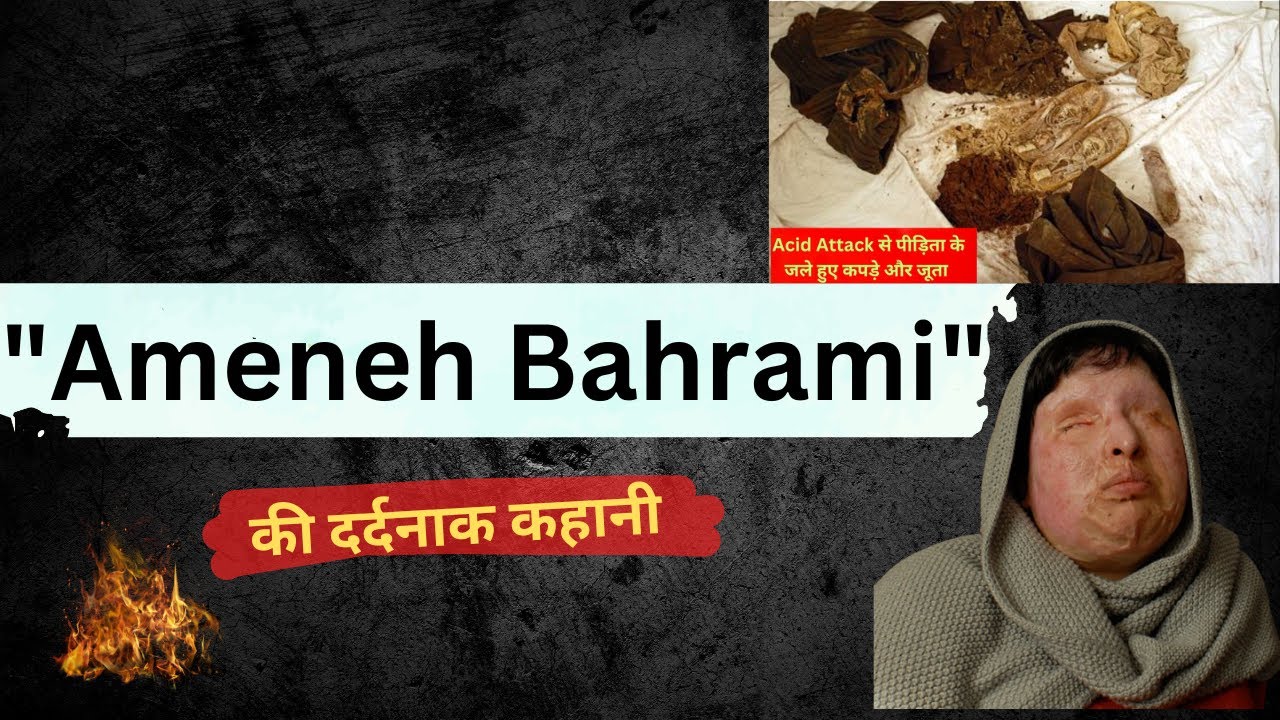 Acid Surviver Ameneh Bahrami Story I कोर्ट का फैसला आरोपी को भी तिज़ाब ...