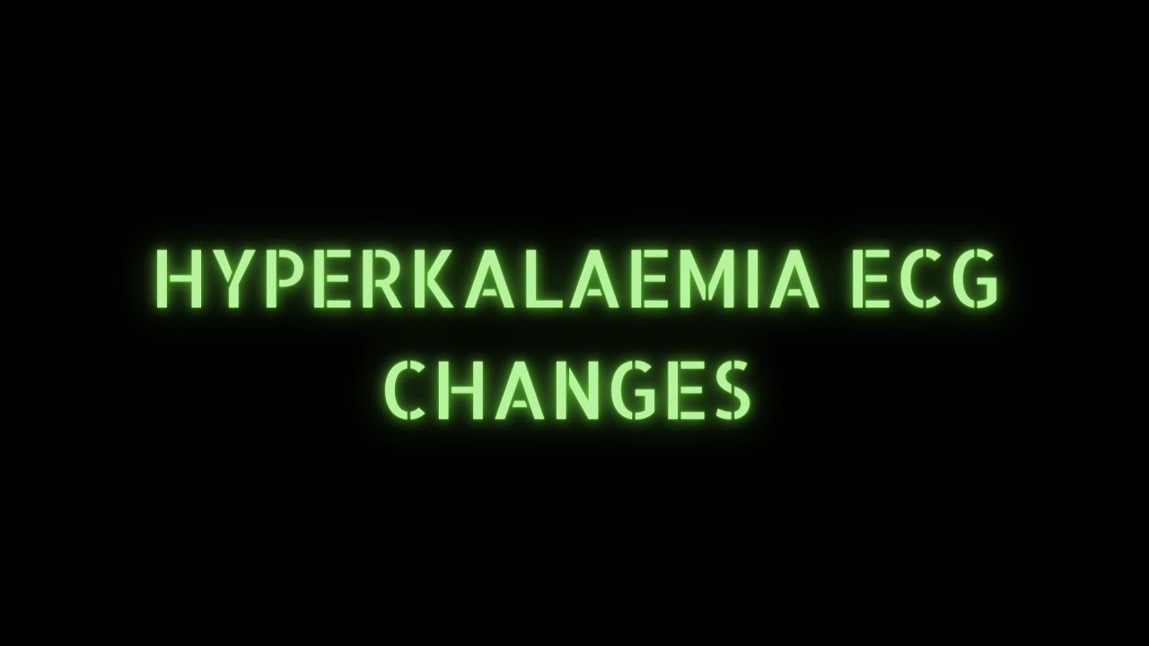 Hyperkalemia: ECG Changes at different Serum Potassium Levels - YouTube