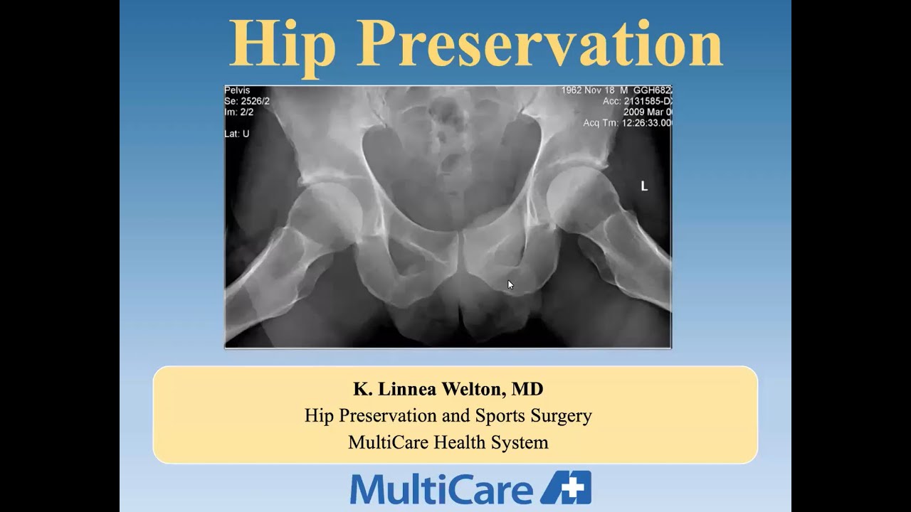 The Benefits & Positive Outcomes of Hip Preservation - YouTube