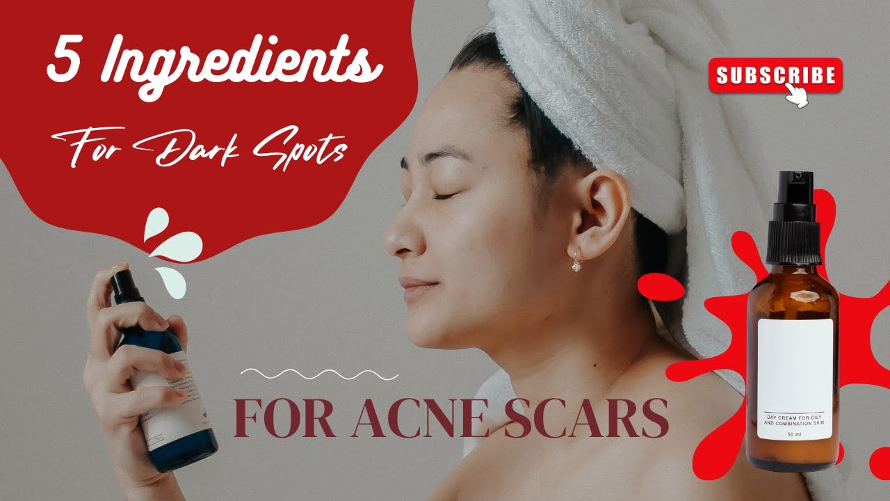 Top 5 Ingredients For Acne Scars & Hyperpigmentation | Dark Spots ...