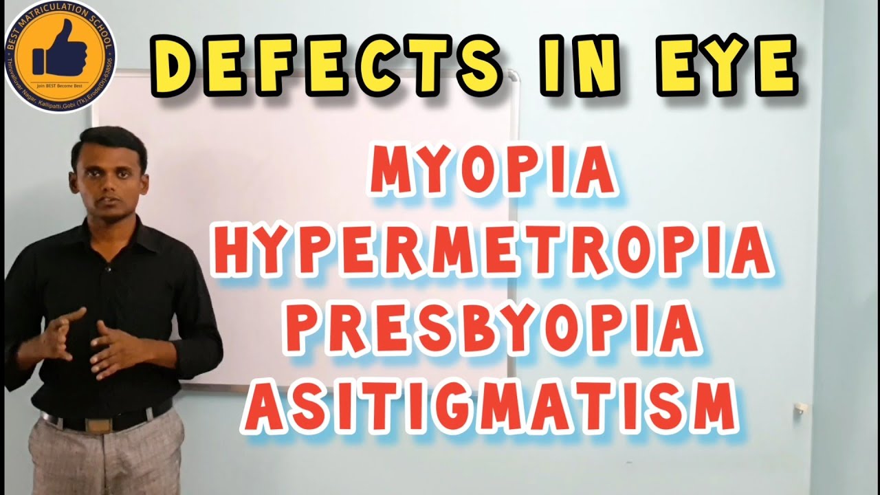 Class 10 - Optics (Light) Part 13 - Defects in Eye (Myopia ...