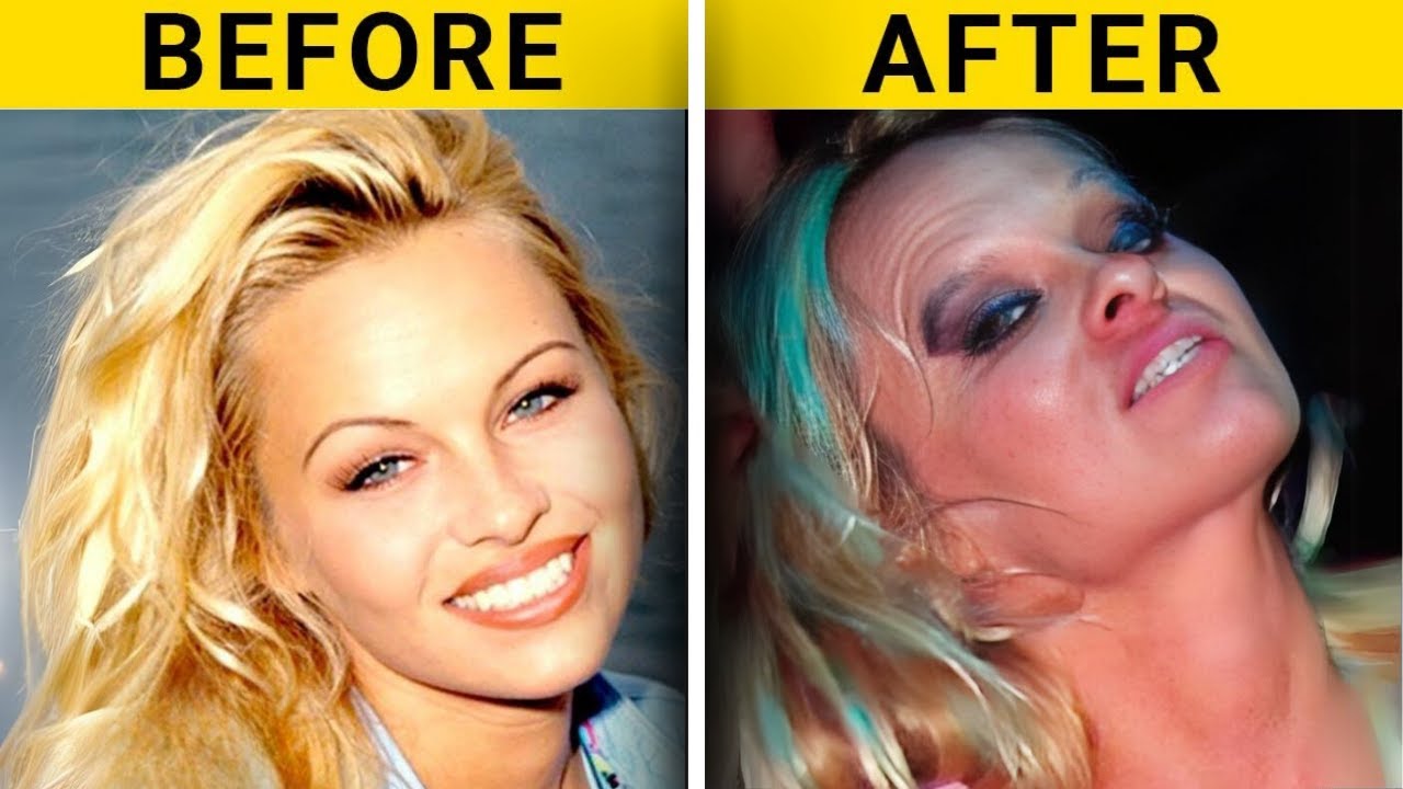 The Rise and Fall of 20 Drug-Addicted Celebrities - YouTube