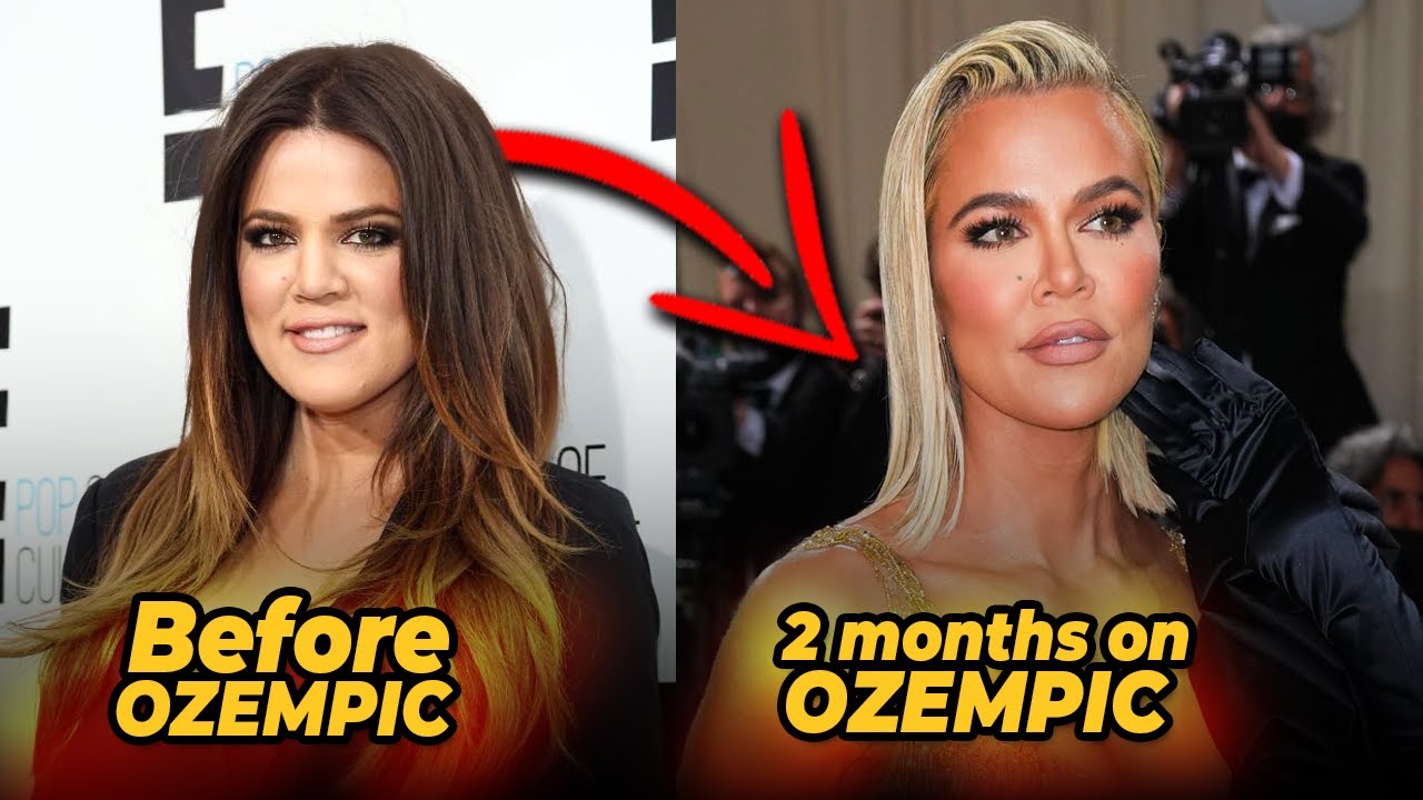Ozempic Weight Loss Before and After – The Dark Side Effects - YouTube