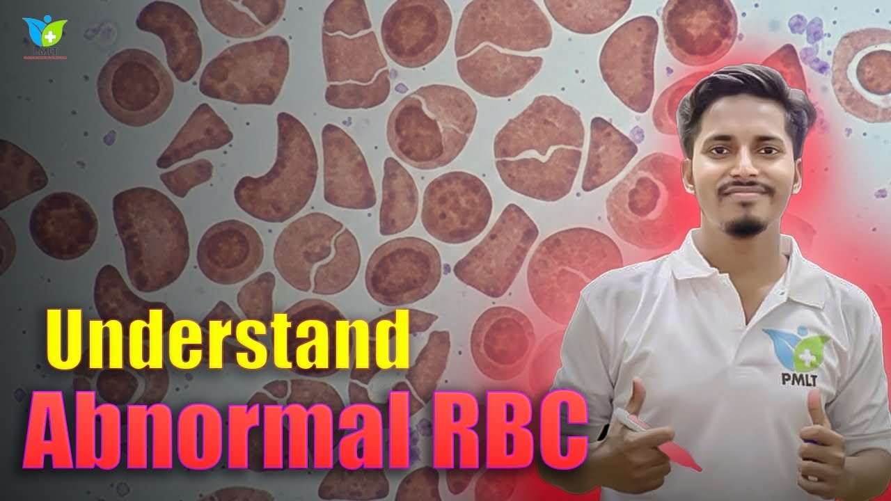 Abnormal RBCs at a Glance | Easiest Explanation for MLT & Paramedical ...