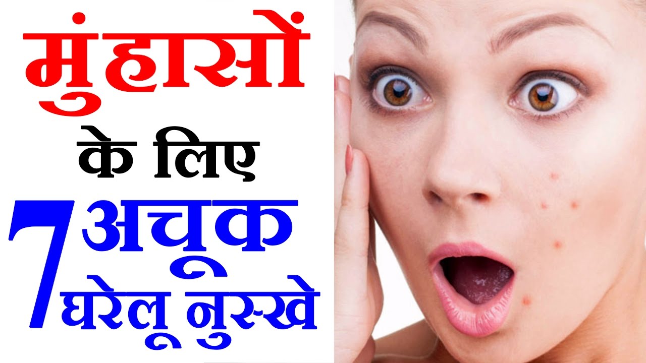 मुहांसों के लिए 7 घरेलू नुस्खे - Muhase ke liye gharelu upay - muhase ...