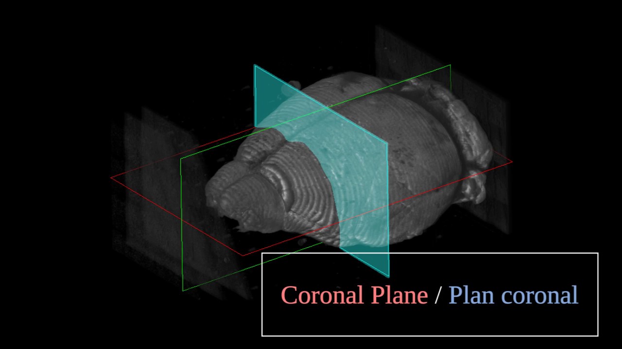 Serial OCT Mouse Brain @ 25 microns - YouTube
