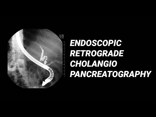 Ercp Vs Mrcp