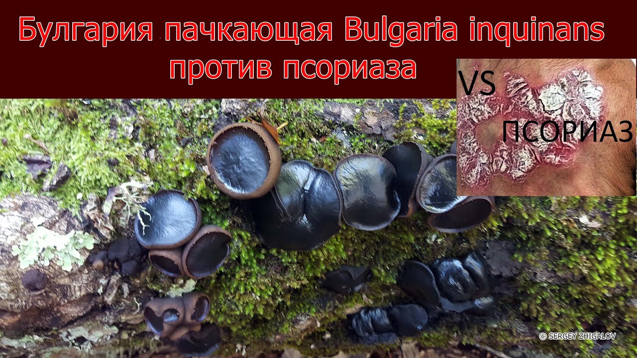 Булгария пачкающая Bulgaria inquinans против псориаза - YouTube