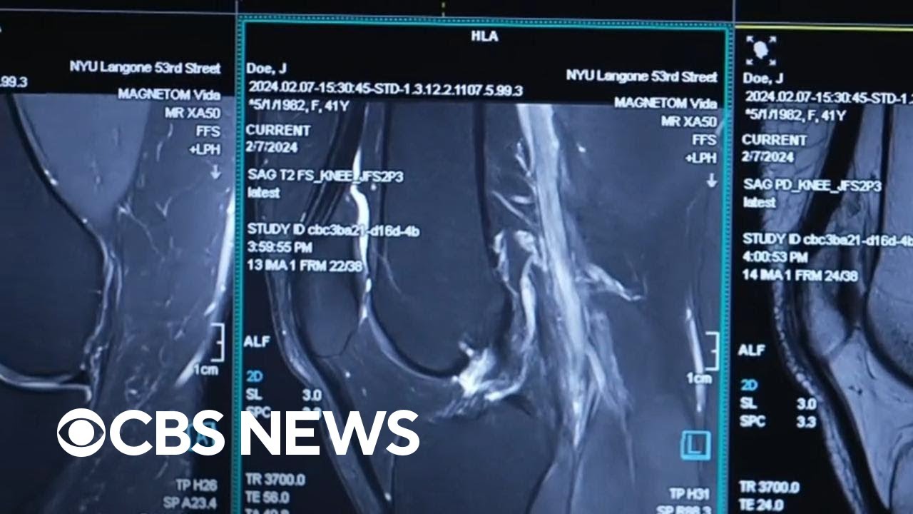 Breakthrough MRI technology uses AI for faster scans - YouTube