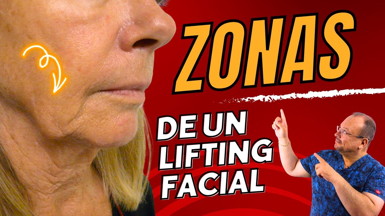 Zonas Del Rostro Para el LIFTING Facial 💕 Tercio Inferior, Medio y ...
