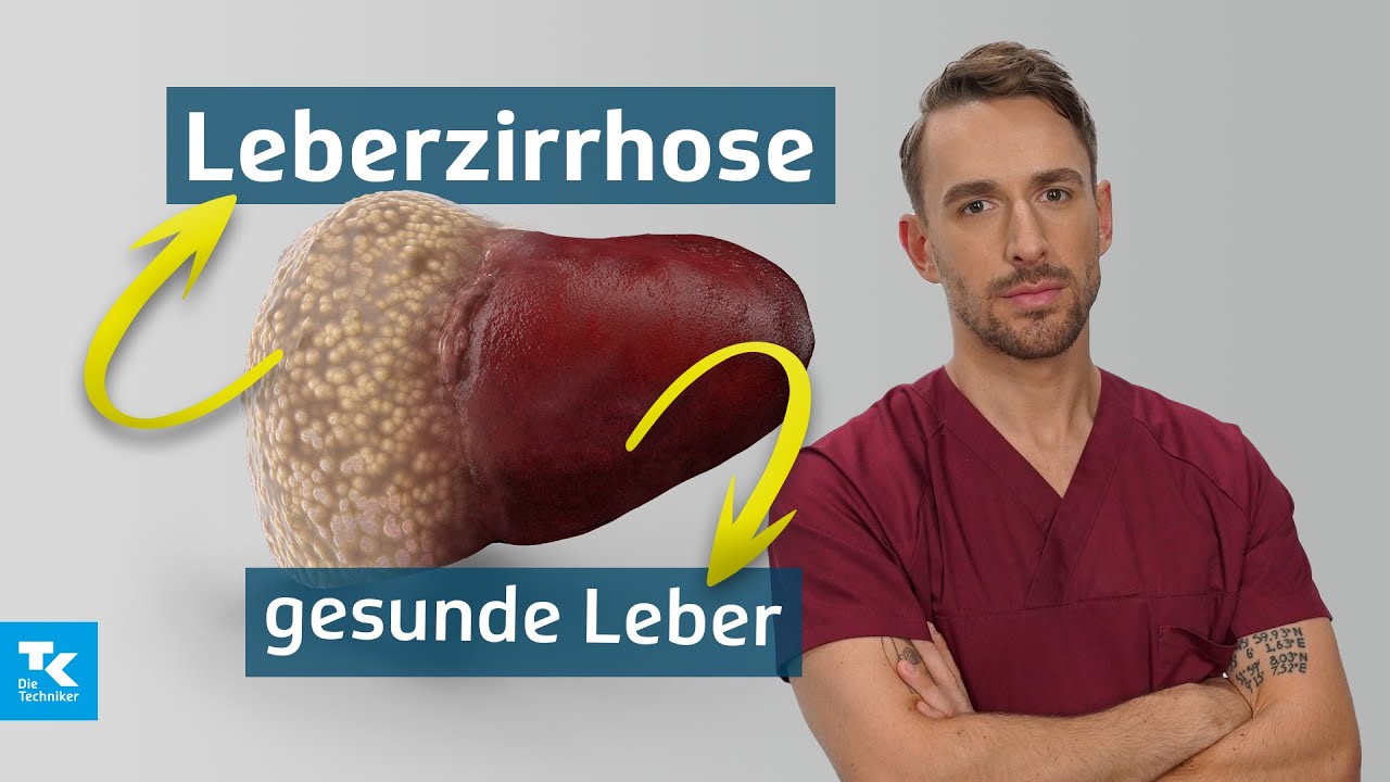Leberzirrhose verstehen: Ursachen, Symptome, Diagnose & Therapie ...