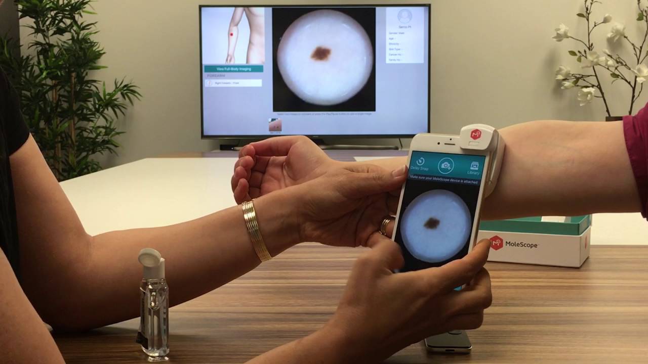 DermEngine Apple TV App - YouTube