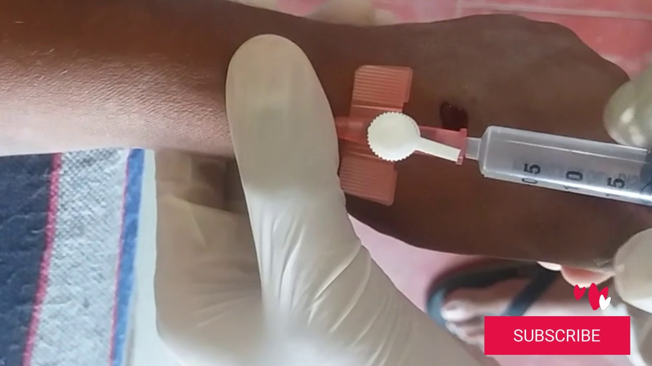 Insertion of canula | Peripheral canulation technique - YouTube