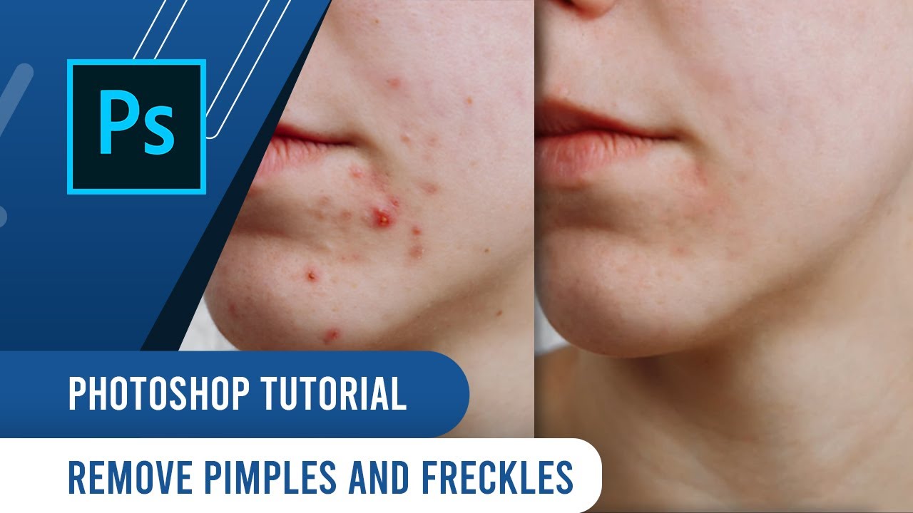 How to Remove Pimples and Freckles in Photoshop - YouTube