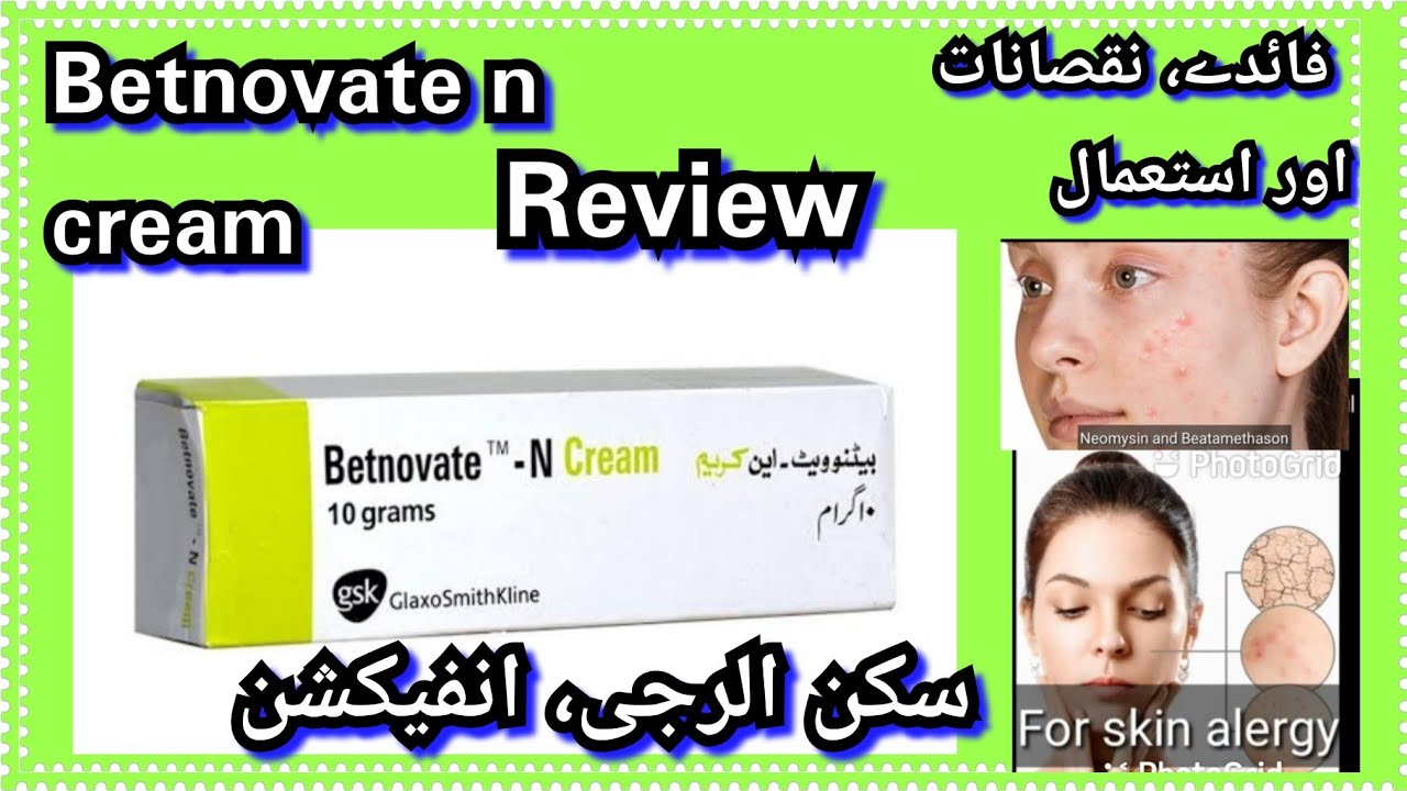 Betnovate N cream,uses, side Effects & benefits/betnovate n cream for ...