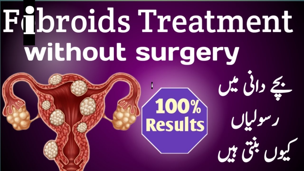 Fibroids Growth in Uterus 😱/bachedani ki rasoian or inka alaj// - YouTube