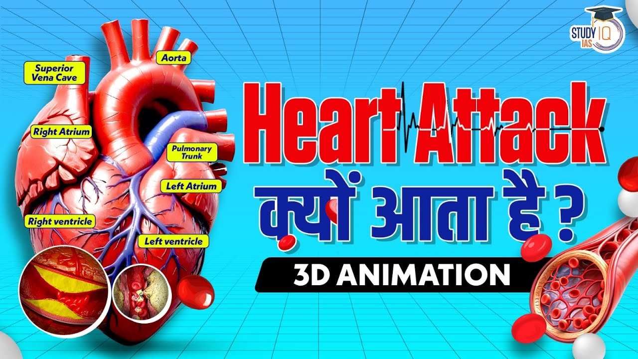 Why HEART ATTACKS Happen? | हार्ट अटैक कैसे होता है? | 3D Animation | StudyIQ IAS - YouTube