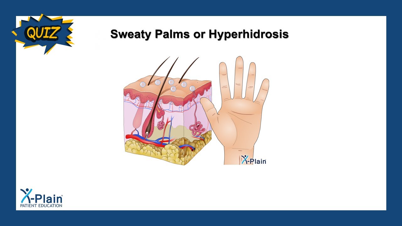 Sweaty Palms or Hyperhidrosis - Quiz - YouTube