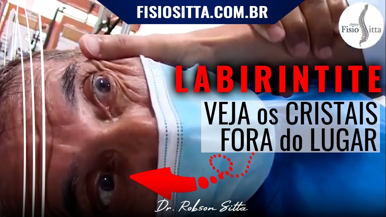 LABIRINTITE SAIBA COMO os CRISTAIS SAEM do LUGAR e CAUSAM VERTIGEM VPPB ...