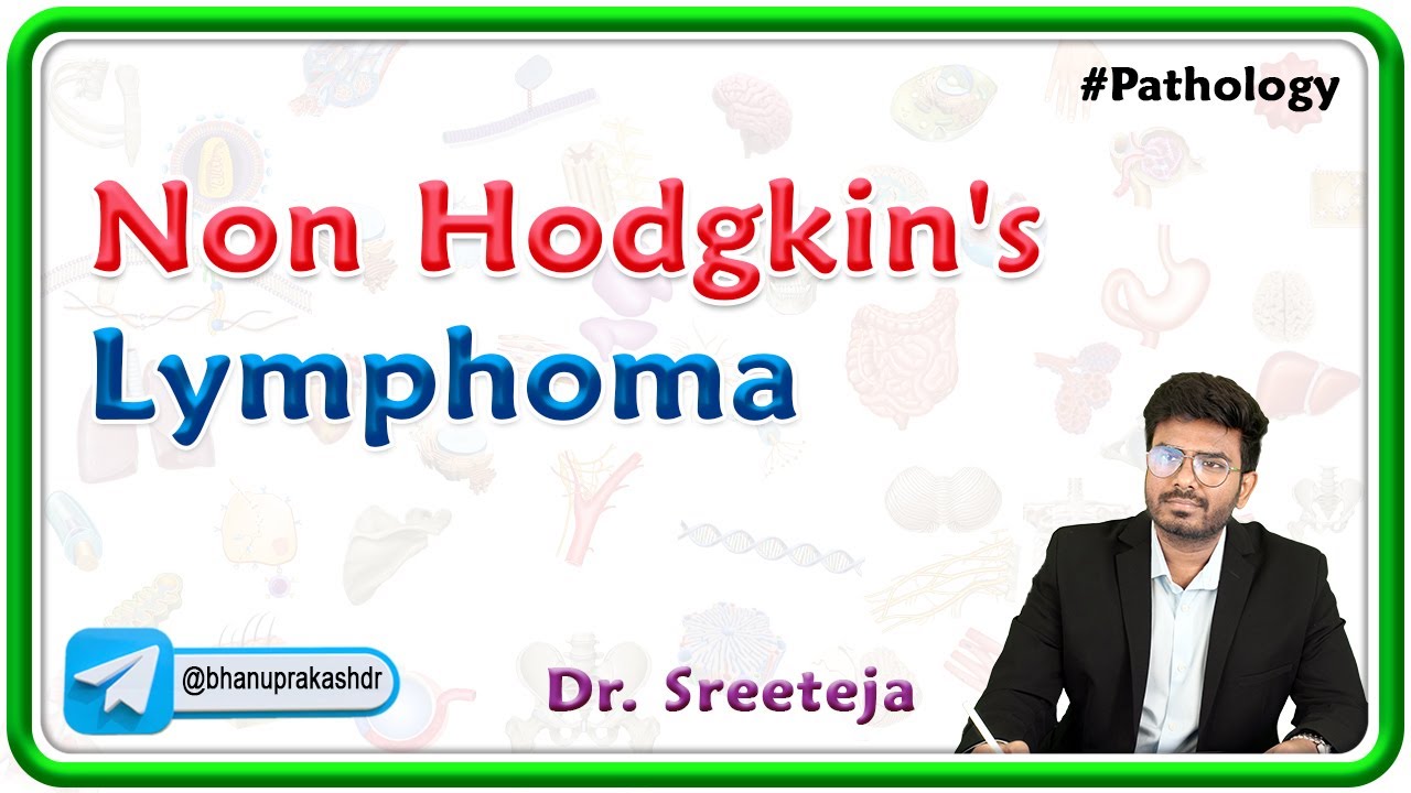 20. Non Hodgkin's Lymphoma | USMLE Step 1 Pathology - YouTube