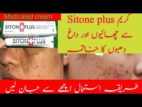 Remove pigmentation,Skin redness,Dark spots with citone plus cream|100% ...